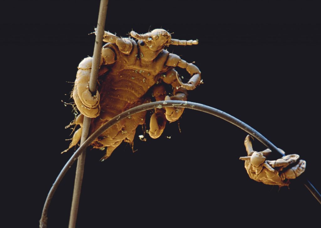 Phthirus Pubis by Nicole Ottawa - Business Recorder