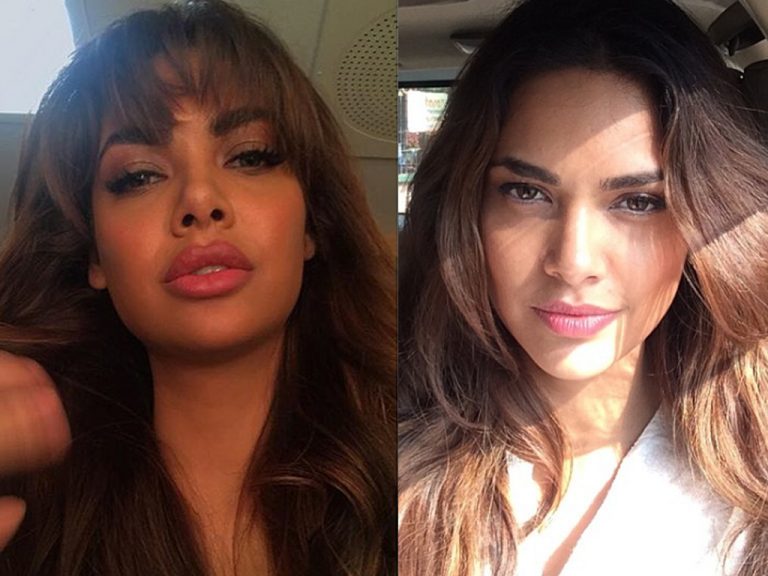 Esha Gupta’s plump pout raises questions about her ‘plastic surgery ...