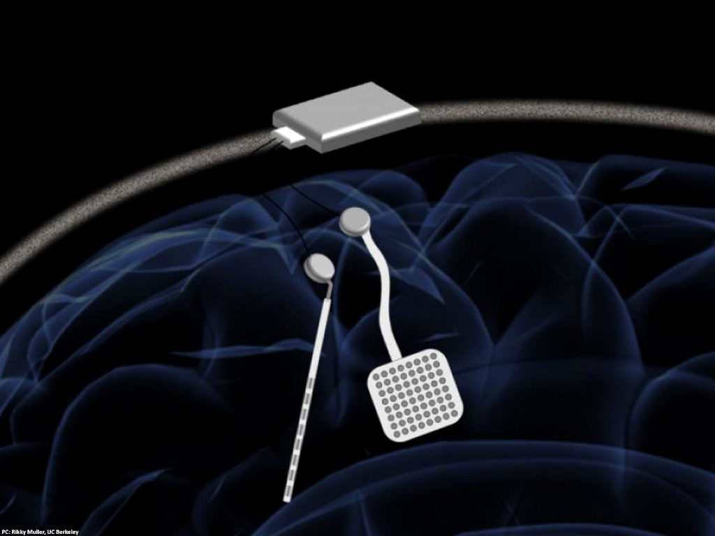 New wireless ‘pacemaker for brain’ to treat epilepsy, Parkinson’s ...