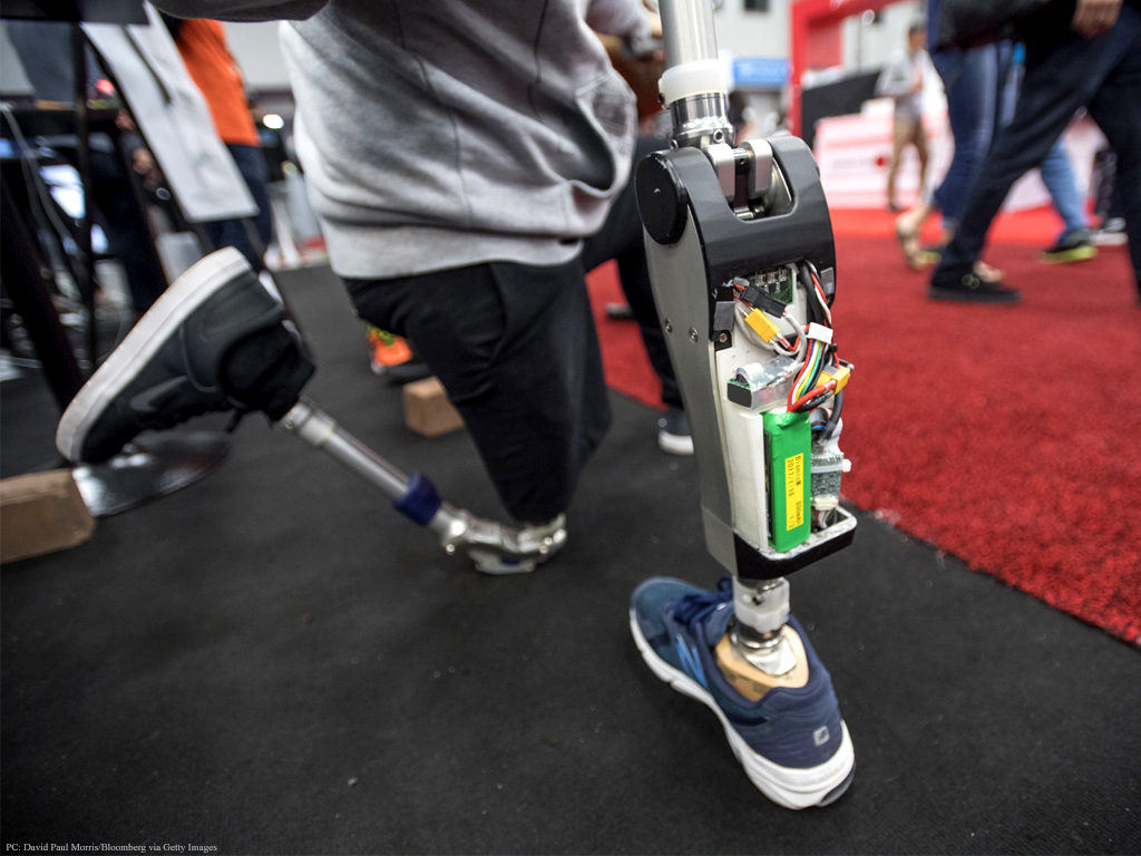 New AI system tunes robotic knee to help amputees walk within minutes ...